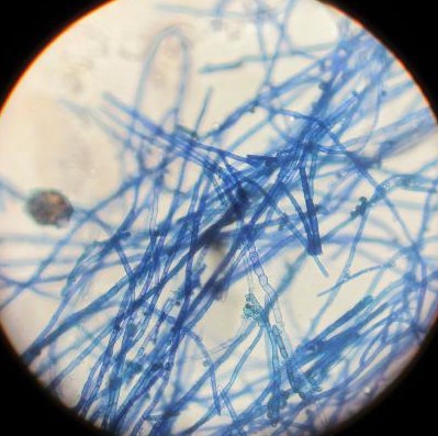 Osservazione al microscopio di cellule di miceti (muffe e lieviti ...