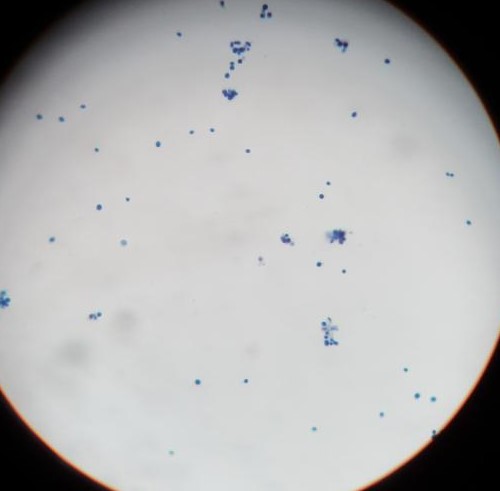 Osservazione al microscopio di cellule di miceti (muffe e lieviti ...